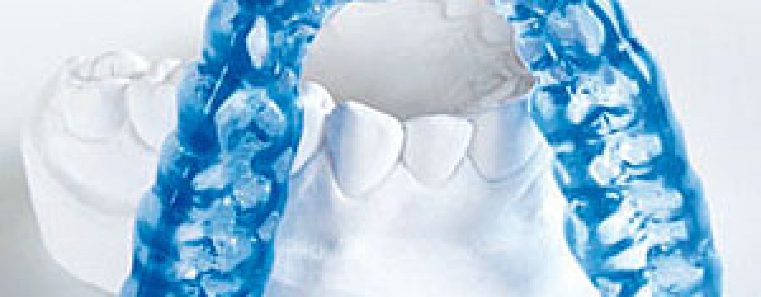 Clearsplint - nester-zahntechnik.de